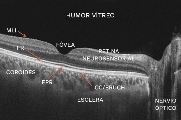 Anatomía de la Retina con OCT